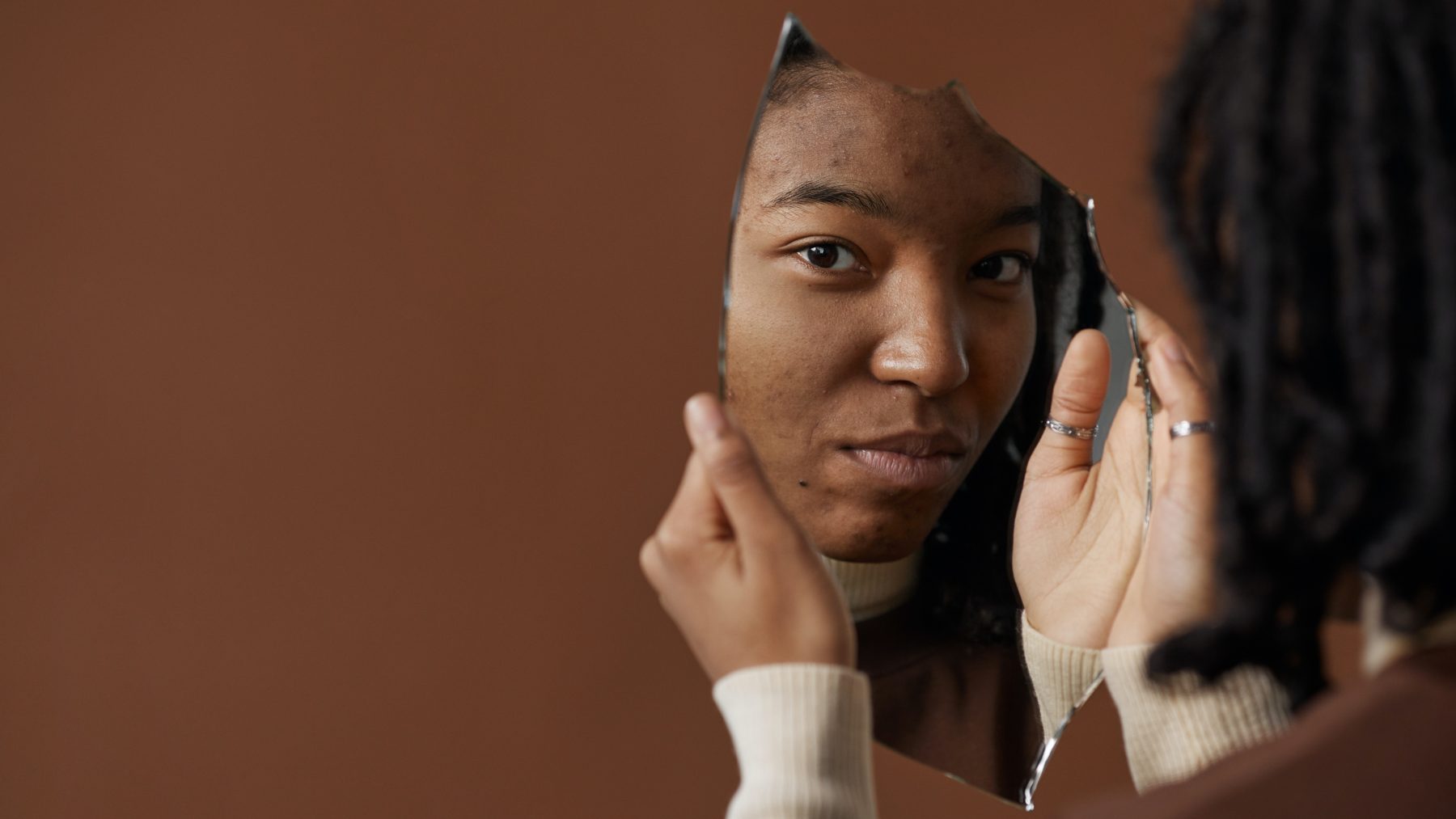 Acne voor volwassenen: wat is het en kun je hier iets tegen doen ...
