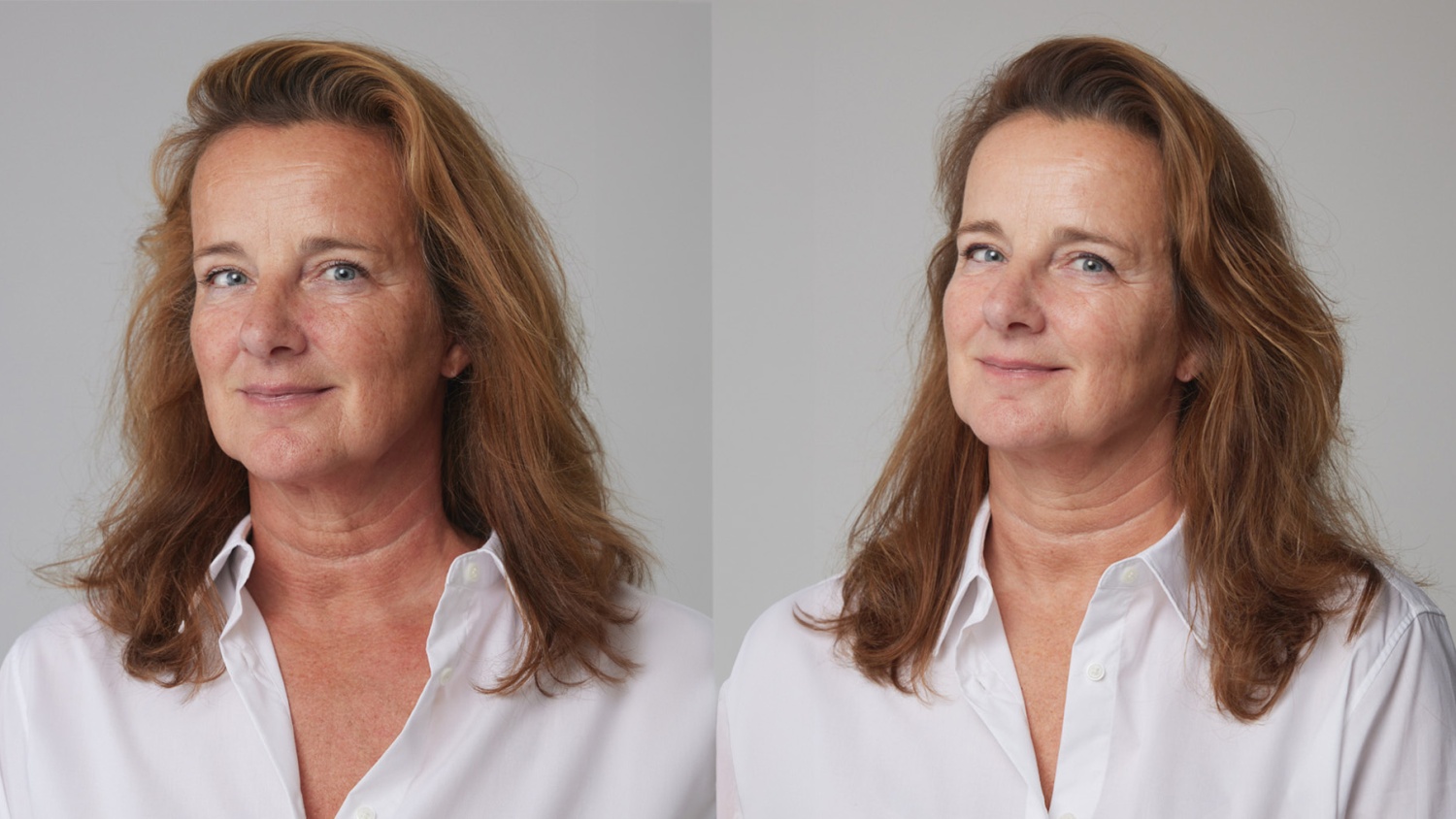 Brenda over hoe haar pigmentvlekken lichter werden door serum - LINDA.nl